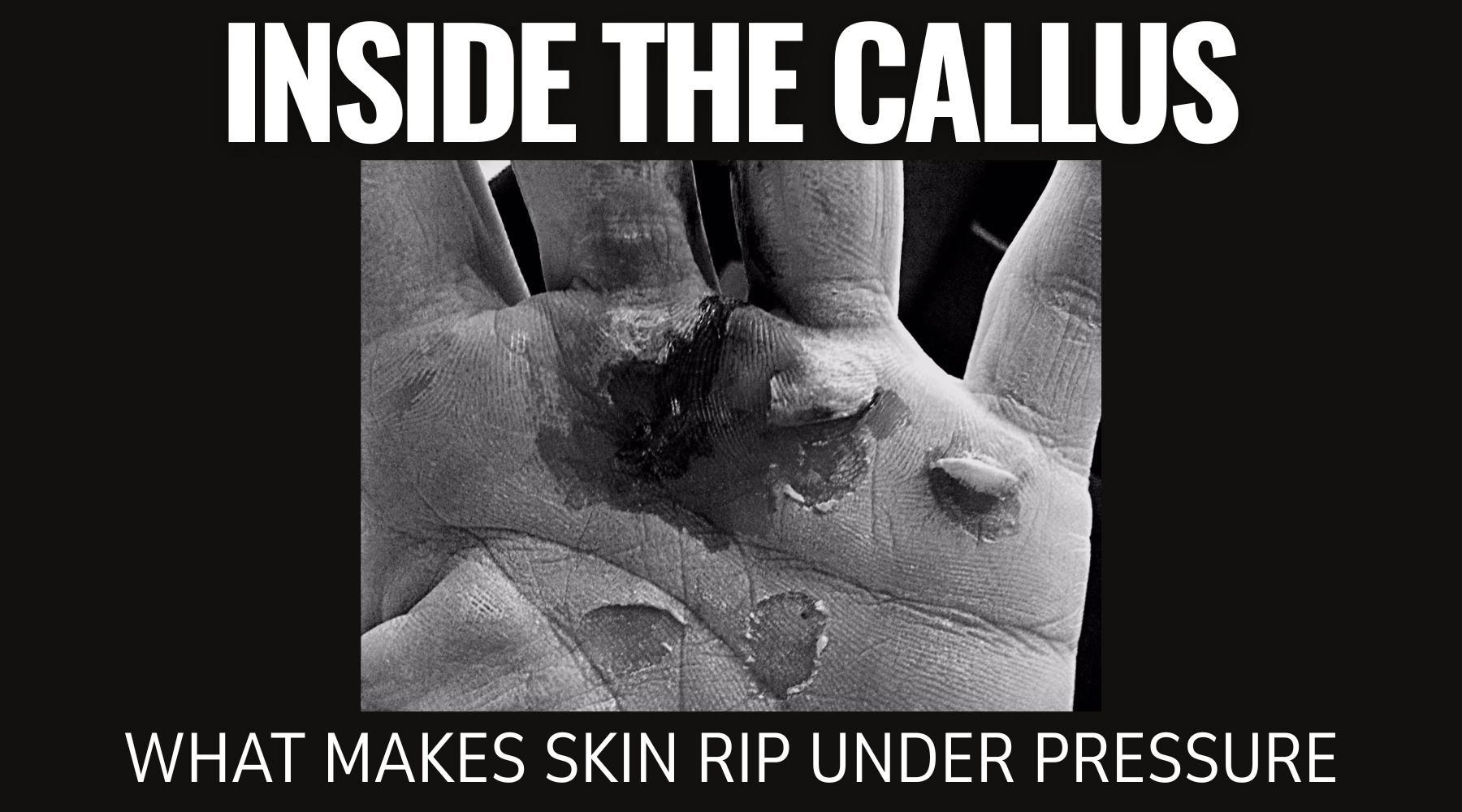Inside the Callus: What Makes Skin Rip Under Pressure – SandBar Hand Care